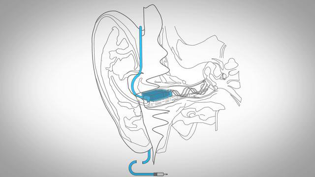 earHero Video for the Most Cover and Tactical Earpiece Ever | Officer