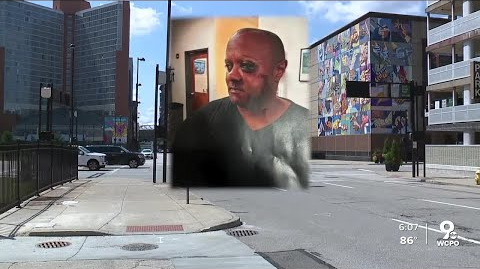 Cincinnati Police Officer Needs Reconstructive Surgery After Attack ...